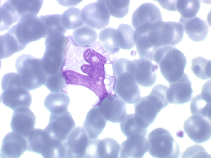 Sang normal : cytolgie descriptive