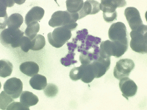 Sang normal : cytolgie descriptive