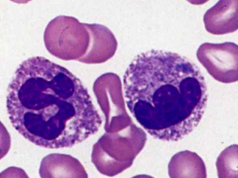 Sang normal : normes